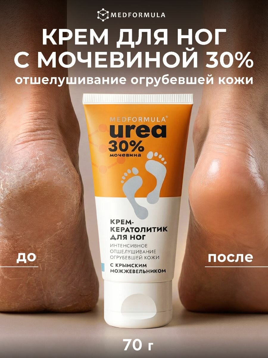 Крем для ног 30% мочевины с крымским можжевельником, 70г