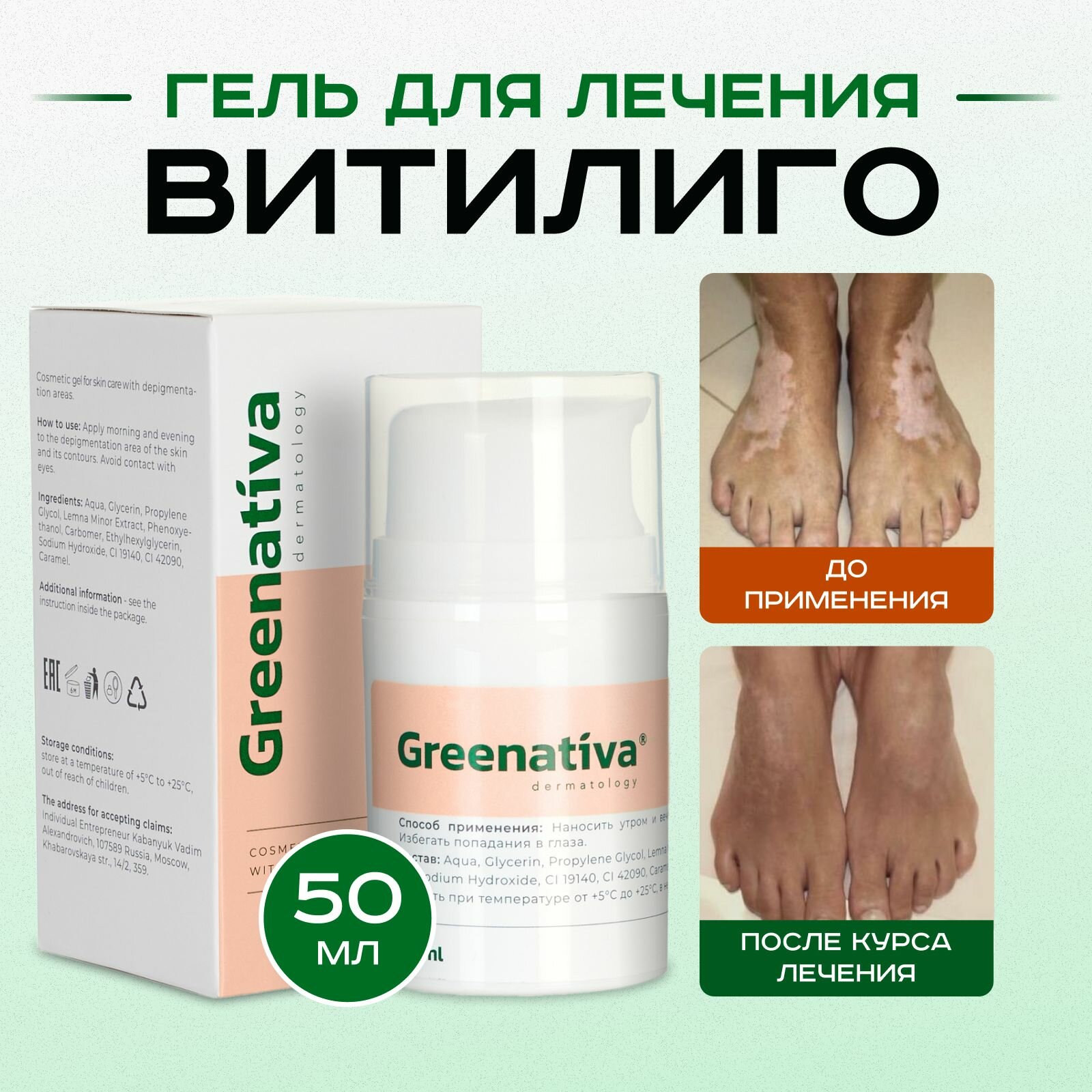 Мазь от витилиго кожи на основе ряски Greenativa