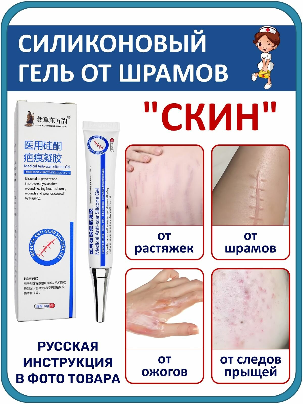 Медицинский силиконовый гель от шрамов, рубцов и растяжек Скин
