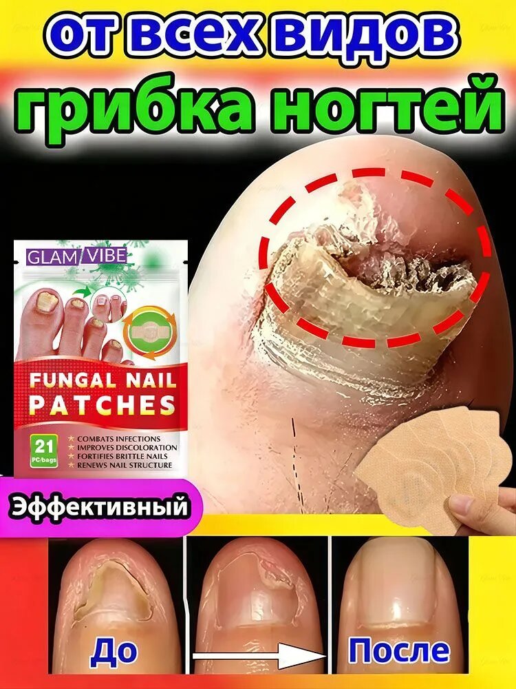 Пластырь от грибка ногтей на ногах, используется для лечения грибковых инфекций, мощное противогрибковое средство, 21 пластырь в упаковке