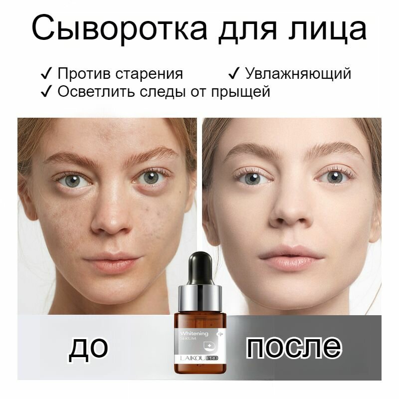 Сыворотка Для Лица, Увлажняющая, Смягчающая, Устраняющая Прыщи, Осветляющая Следы От Прыщей
