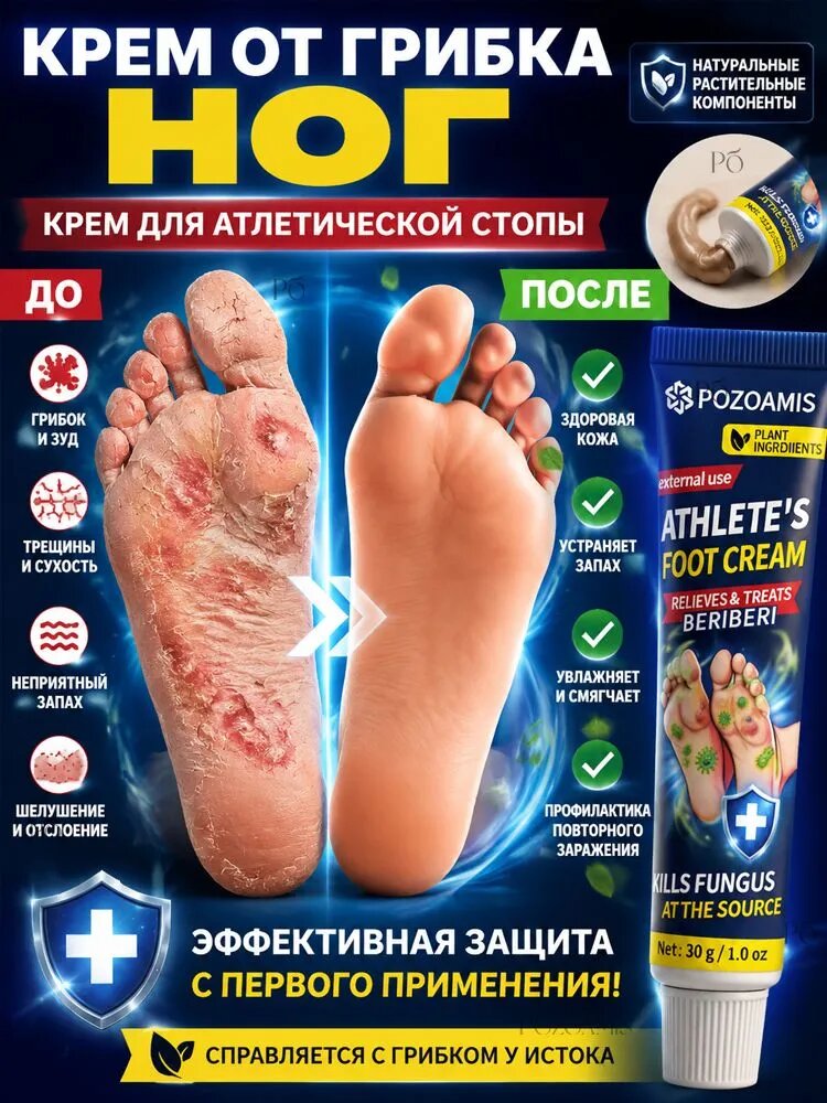 Один тюбик мази. 30 грамм, для лечения онихомикоза (грибкового поражения ногтей). Эффективна при лечении грибковых инфекций ногтей на ногах.