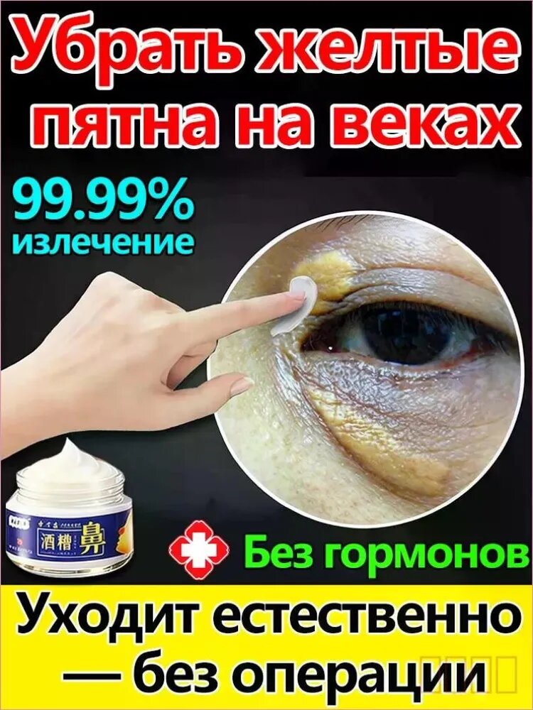 Мазь от ксантелазмы и ксантом на веках и лице. Лечение папул и желтых бляшек вокруг глаз. Эффективное средство против атеромы