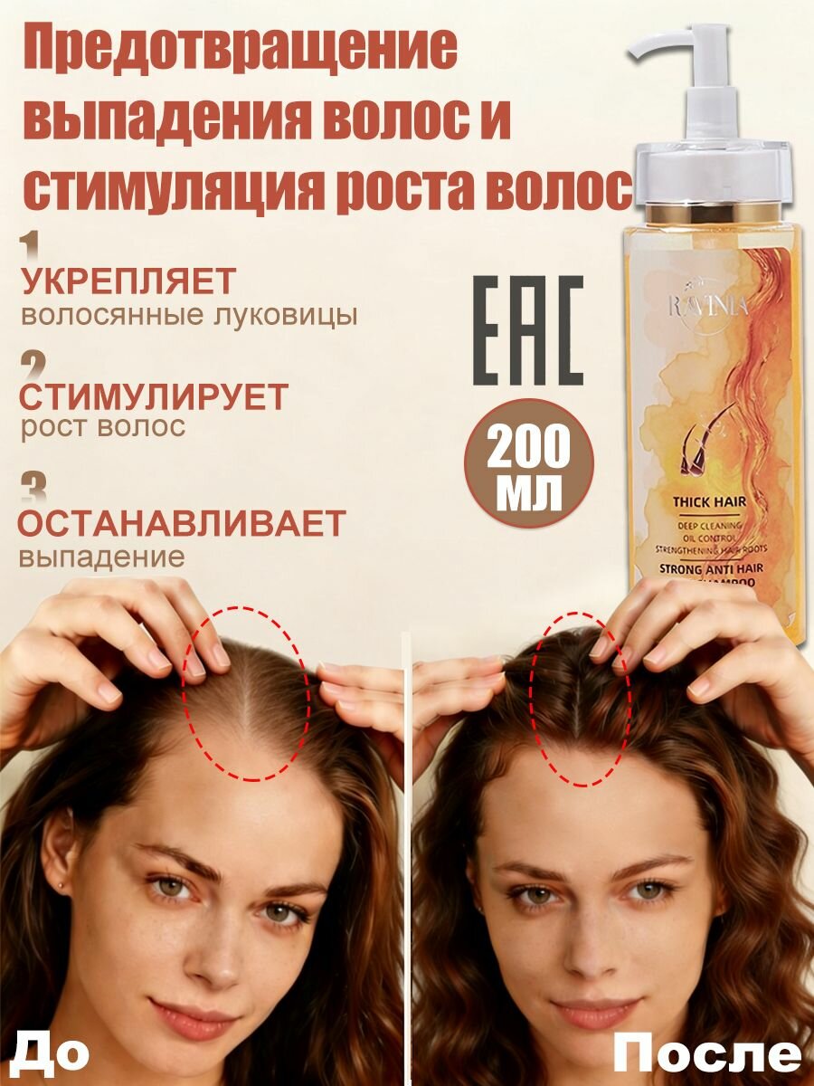 RAVINIA Шампунь для роста волос: объем +600%, защита от выпадения. Натуральный, сертифицированный. Безопасен для беременных. 200 мл.