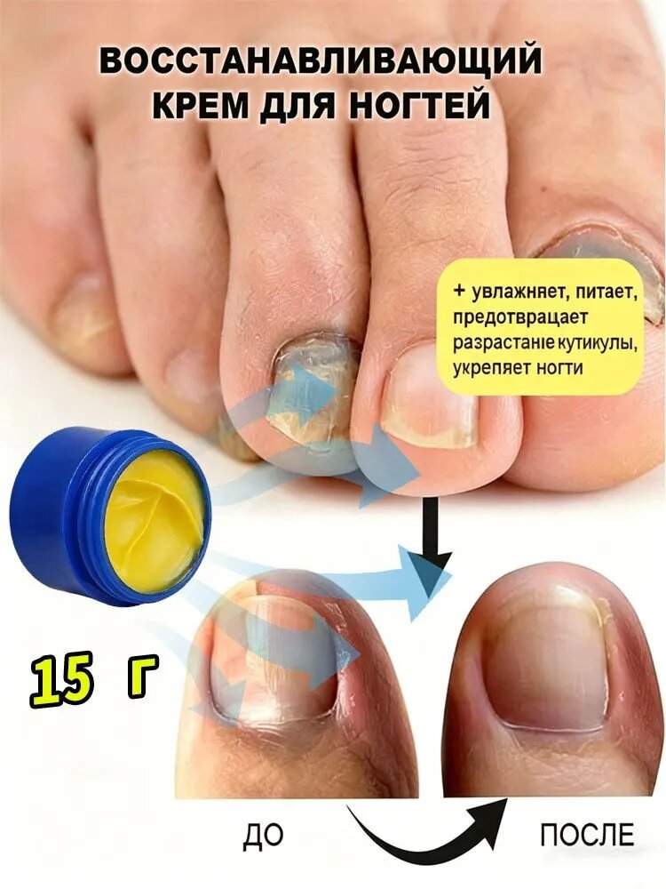 Крем для ногтей и кутикулы, против ломкости и расслоения, 15 г