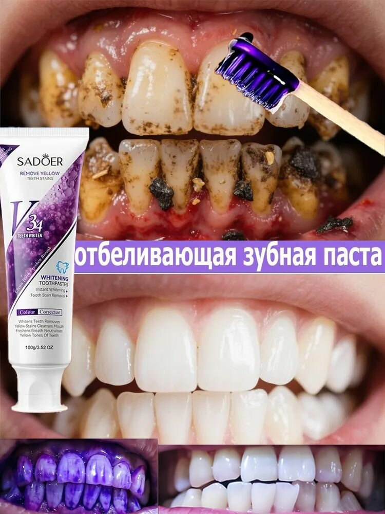 Зубная паста v34 для отбеливания, устраняет зубной налет, пятна от курева, чая и кофе, зубной камень, восстанавливает эмаль, 100 г.