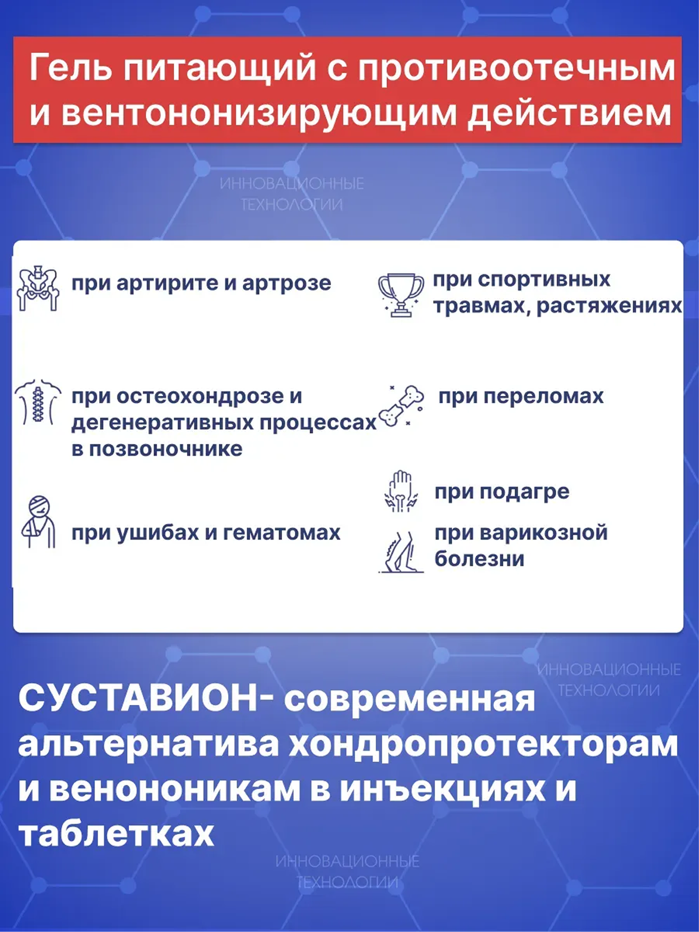 Суставион гель питающий для наружного применения 50г — фото 1