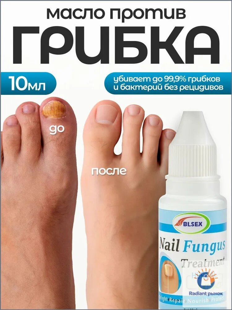 Премиальное средство от грибка ногтей Nail Fungus, 10 мл, применяется для терапии онихолизиса.