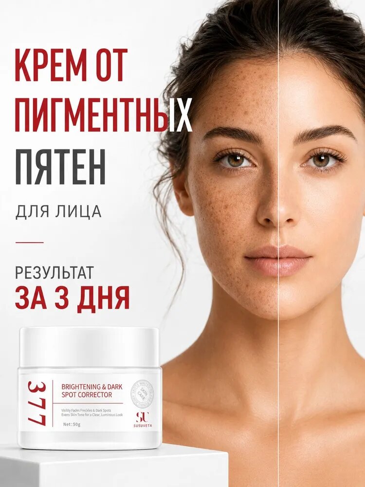 Kрем против пигментных пятен и веснушек, отбеливающий от пигментации, Ночной и дневной для кожи лица и тела,30г