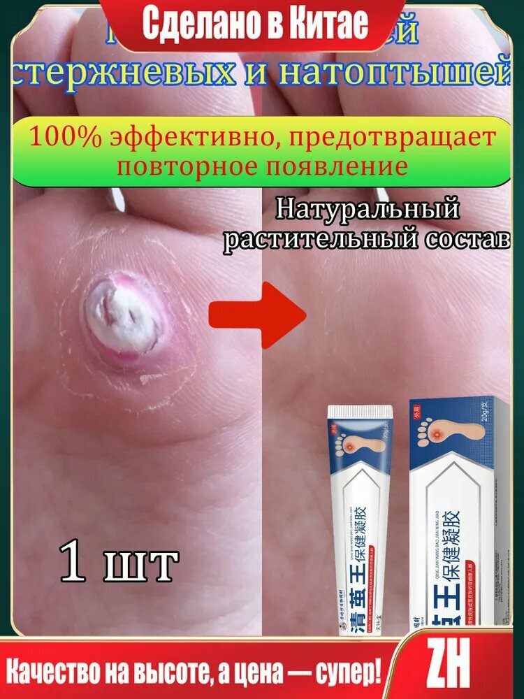 Mазь от мозолей стержневых и натоптышей , Крем от сухих мозолей, шипицы, бородавок, натоптышей,20 г 1 шт.