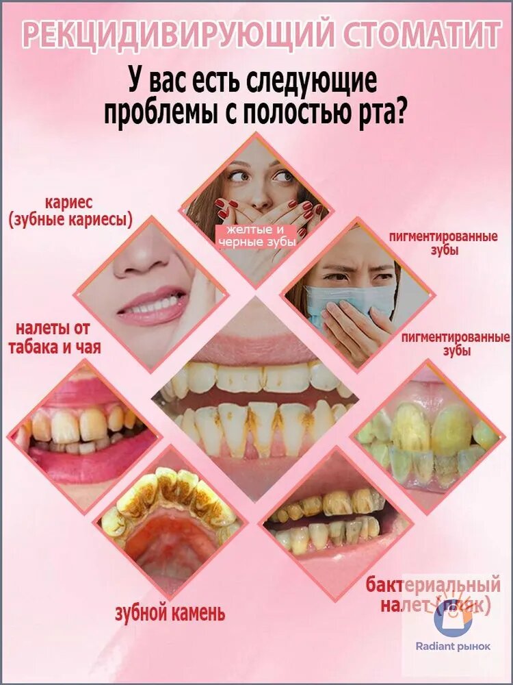 Эффективная отбеливающая зубная паста: осветляет жёлтые зубы, удаляет налёт от чая и кофе, помогает в профилактике кариеса и снижает чувствительность. Объём: 100 г.