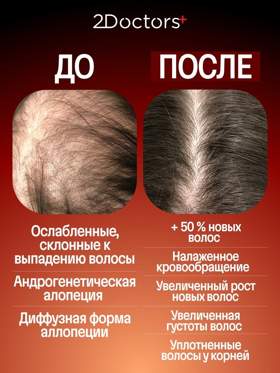 2Doctors Маска для волос, 240 мл — фото 1