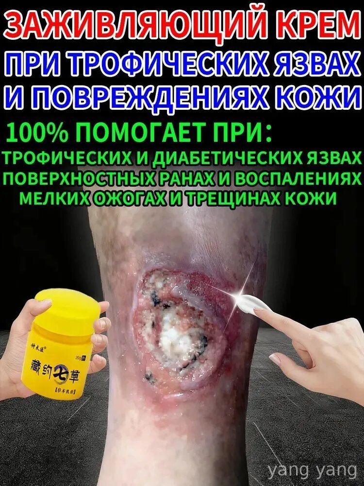 Крем при трофических язвах и сухих трещинах кожи