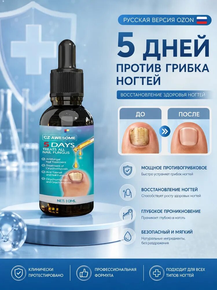 Уход за ногтями при грибке, лак для ногтей, противогрибковое лечение ногтей, лечение грибковых инфекций рук и ног.