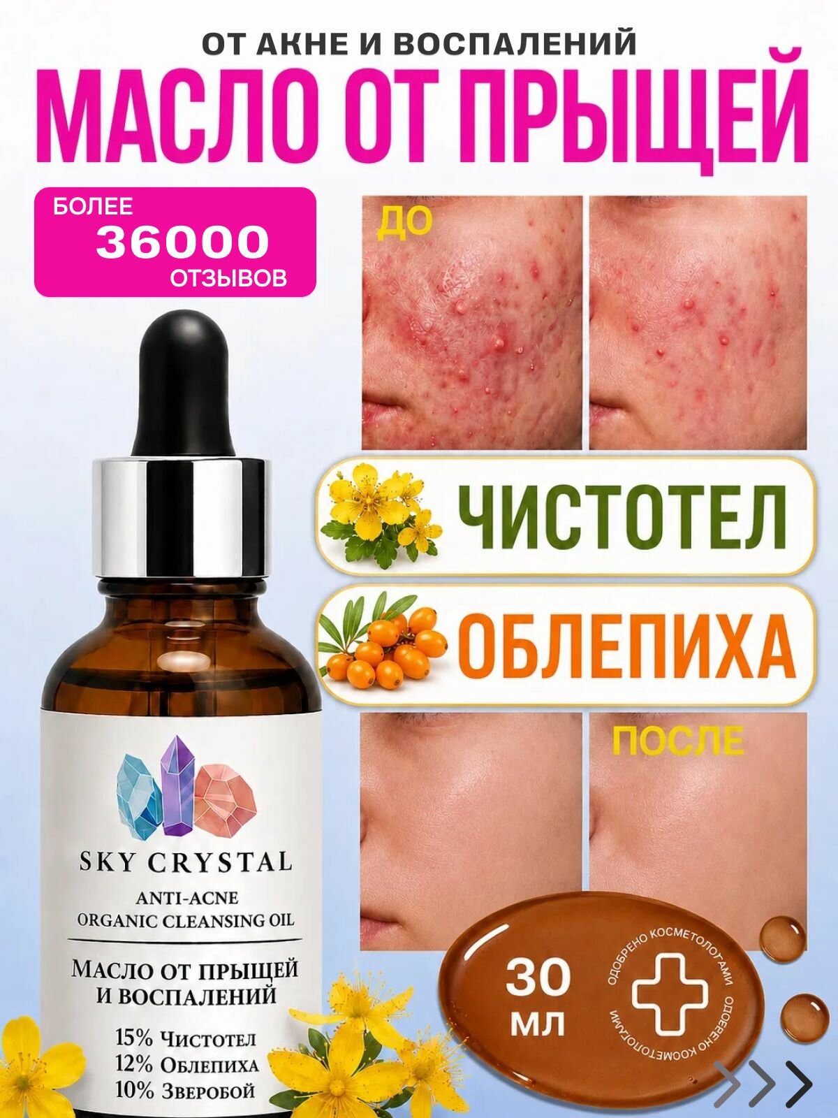 Натуральное масло сыворотка для лица от прыщей с Чистотелом 15% Облепихой 12% Зверобоем 10% и Виноградной косточкой Sky Crystal, средство от воспалений для проблемной кожи от постакне, 30 мл против акне для постакне уход за воспаленной коже