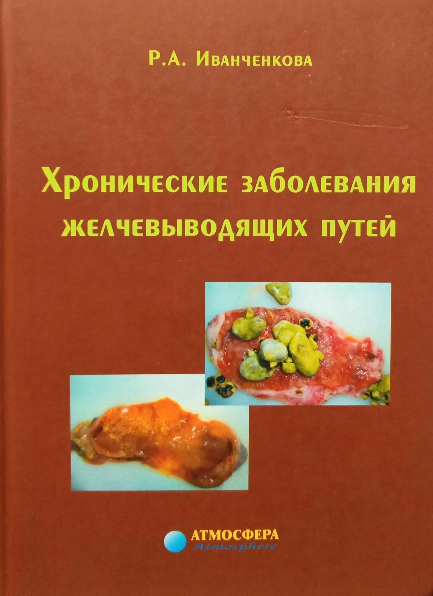 Хронические заболевания желчевыводящих путей
