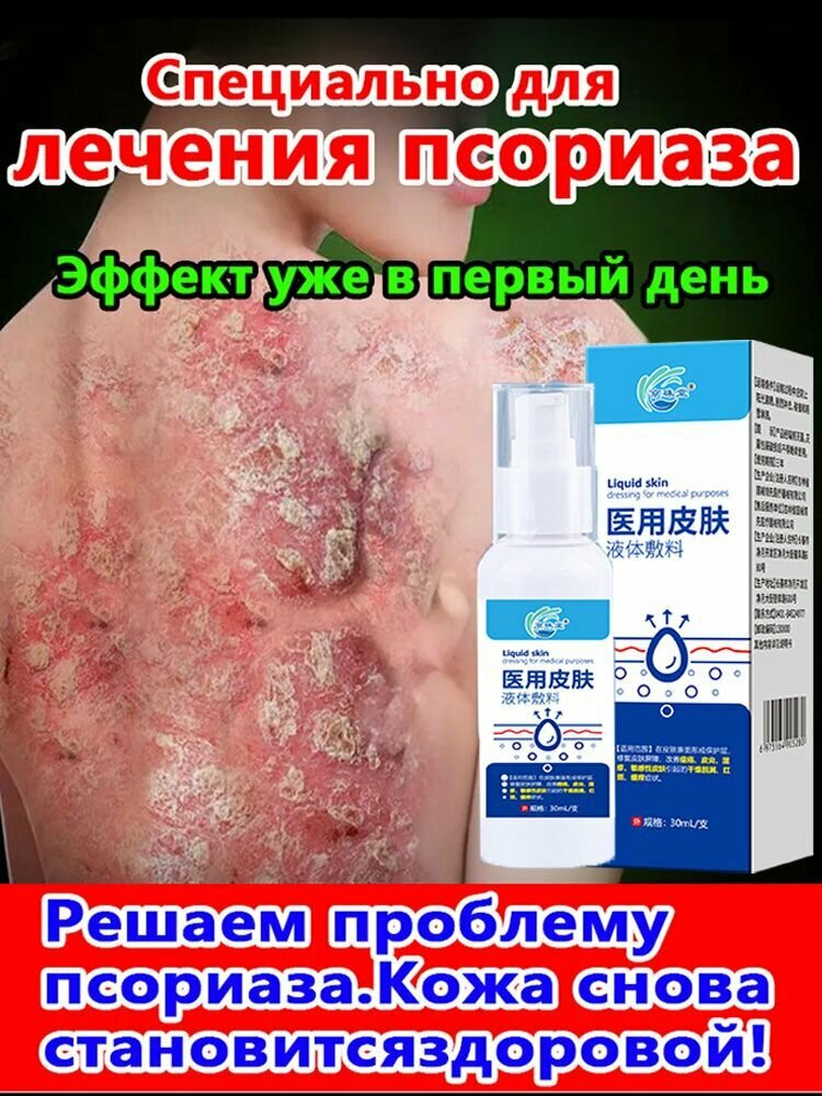 Антибактериальная и противозудная мазь, используется для лечения псориаза, себорейного дерматита, экземы, зуда, акне, против различных грибков