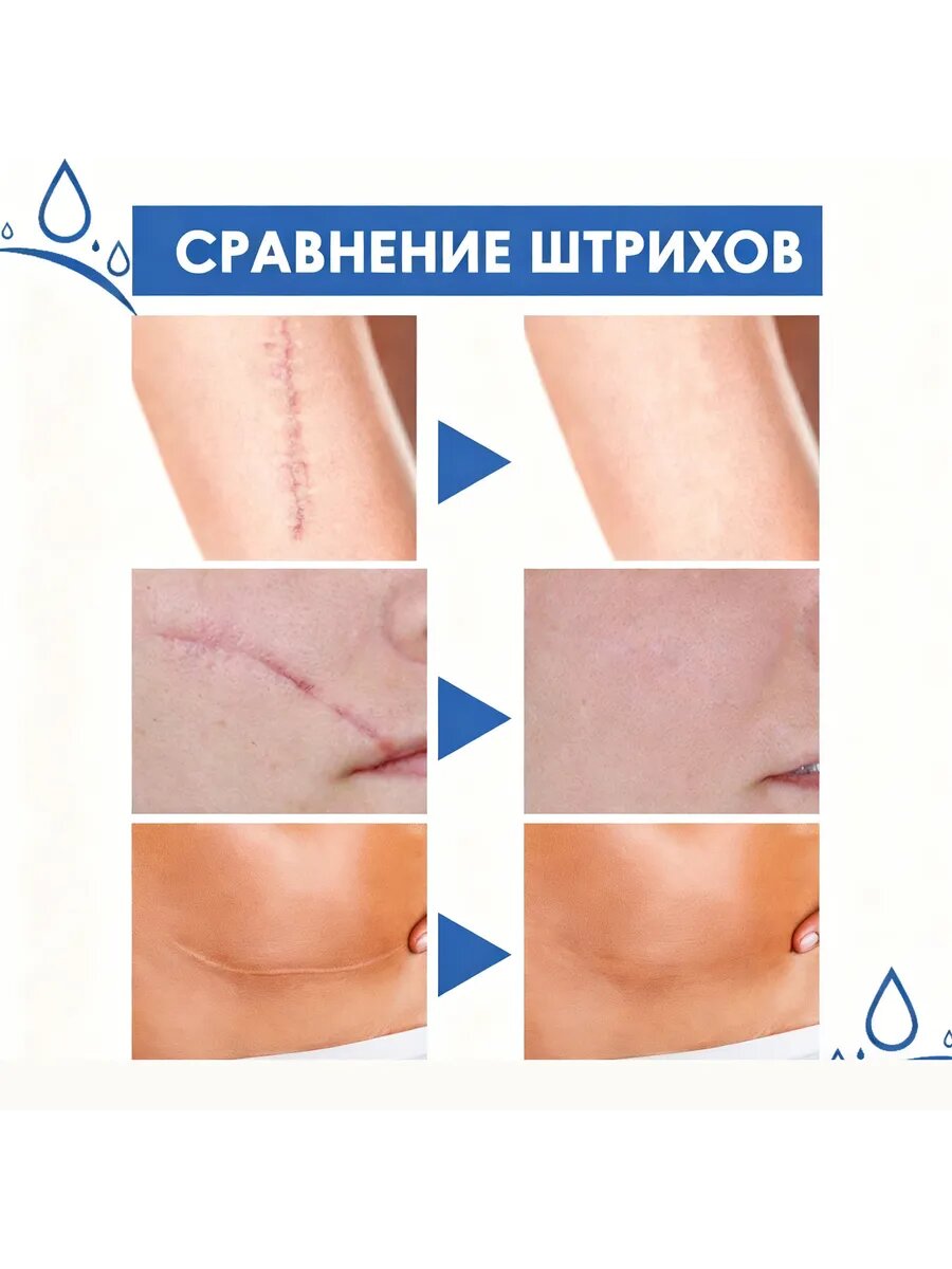 Крем для ухода за кожей: мягкая наружная мазь, увлажняющая и разглаживающая кожу. — фото 1