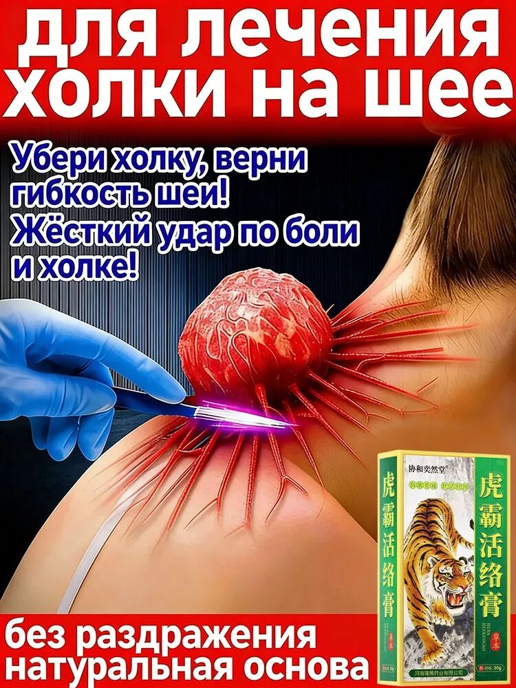 Вдовий горб на шее, мазь от остеоартрита шеи и обезболивающее для спины, китайская чудо-мазь от опухолей и отеков, для удаления шишек и снятия онемения и скованности, 20 г