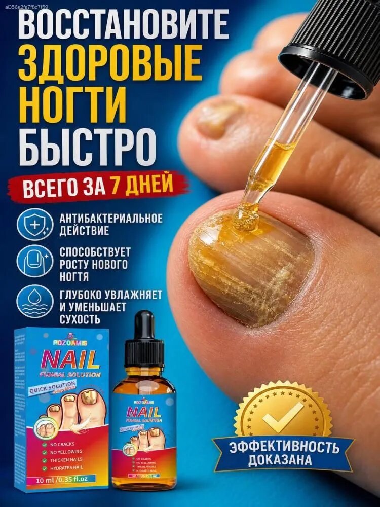 Эфирное масло от грибка ногтейЛечите онихомикоз рук и ног, ухаживайте за ногтями и кутикулой, улучшайте состояние паронихия и удаляйте онихомикоз, а также лечите грибковые инфекции.10 мл