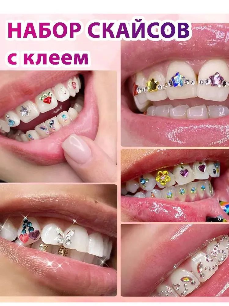 Скайсы для зубов, 1шт, цвет: белый, материал: Пластик