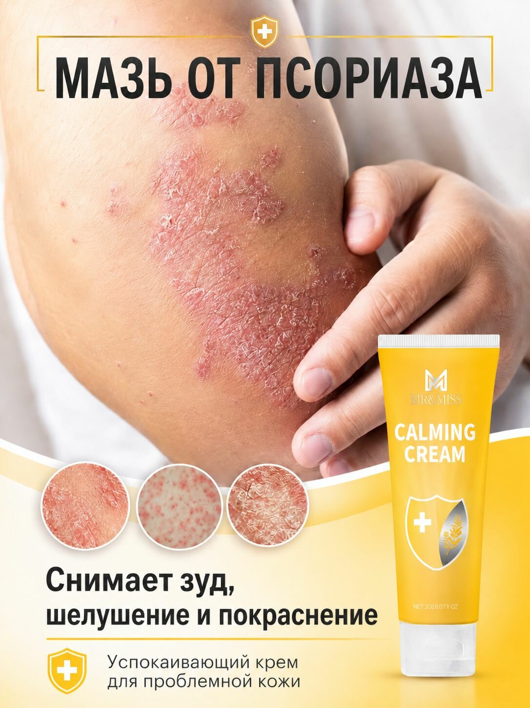Мазь от псориаза, Высокоэффективное средство против зуда без рецидивов, подходит для лечения проблемных кожных заболеваний, таких как псориаз, экзема и грибковые инфекции, 20 г