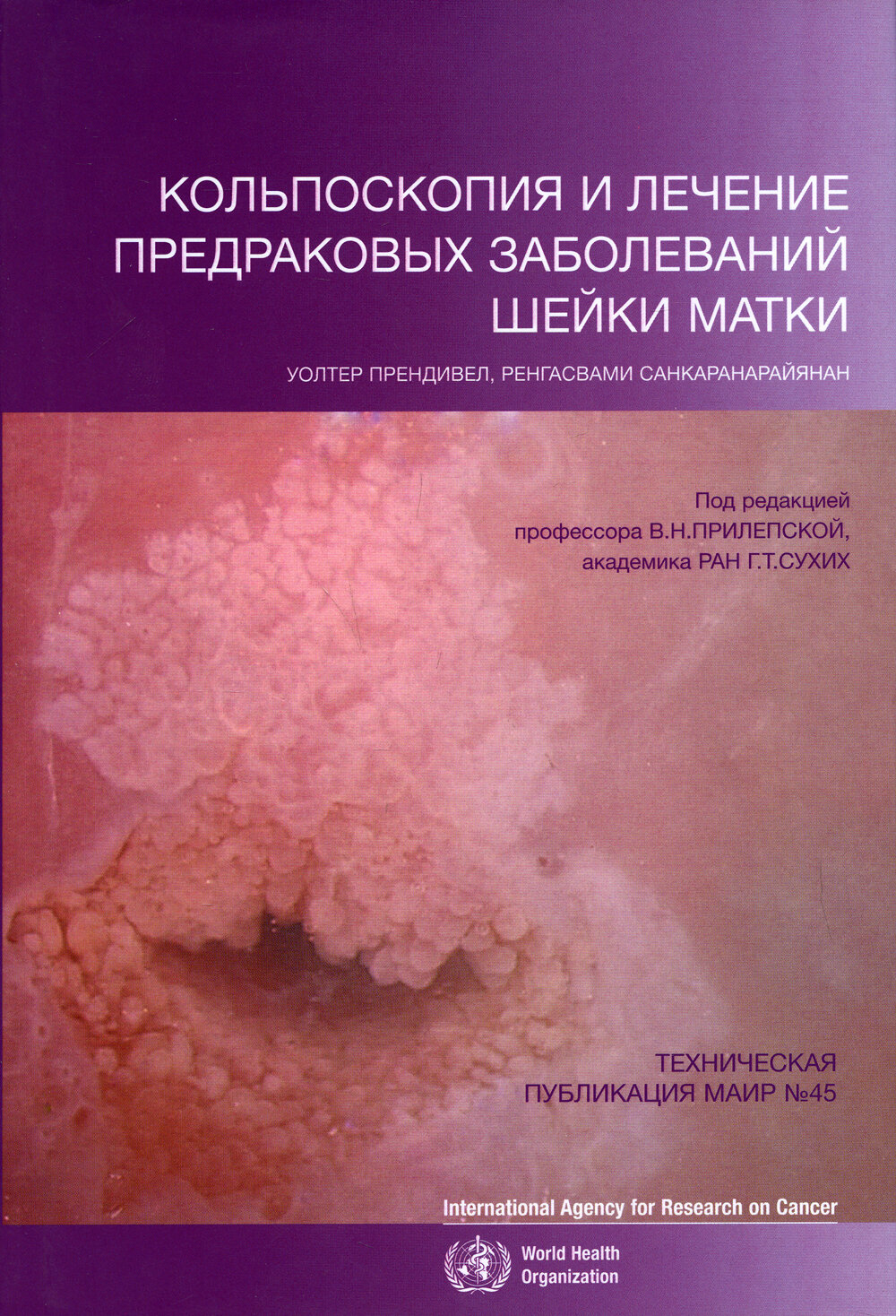 Уценка Кольпоскопия и лечение предраковых заболеваний шейки матки. Прендивел У., Санкаранарайянан Р.