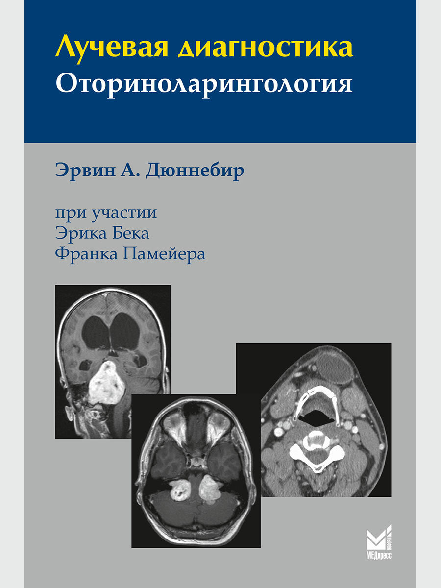 Лучевая диагностика. Оториноларингология