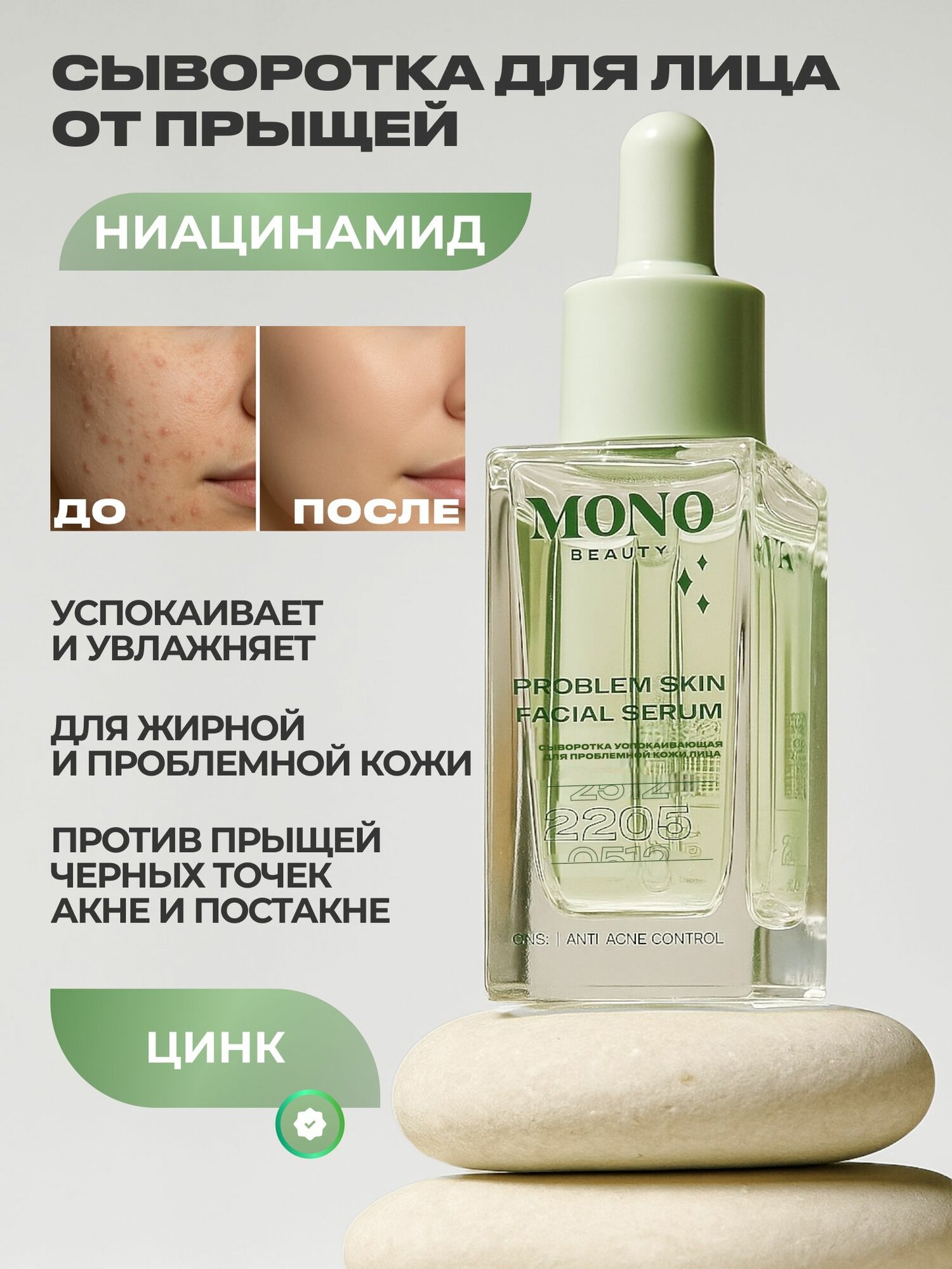 Сыворотка для лица от прыщей, акне и черных точек с ниацинамидом и цинком, успокаивающая для проблемной кожи MonoBeauty, 30 мл