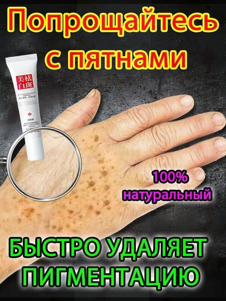 Отбеливающий крем от веснушек и солнечных пятен, подходит для удаления и исчезновения желтых пятен и старчес