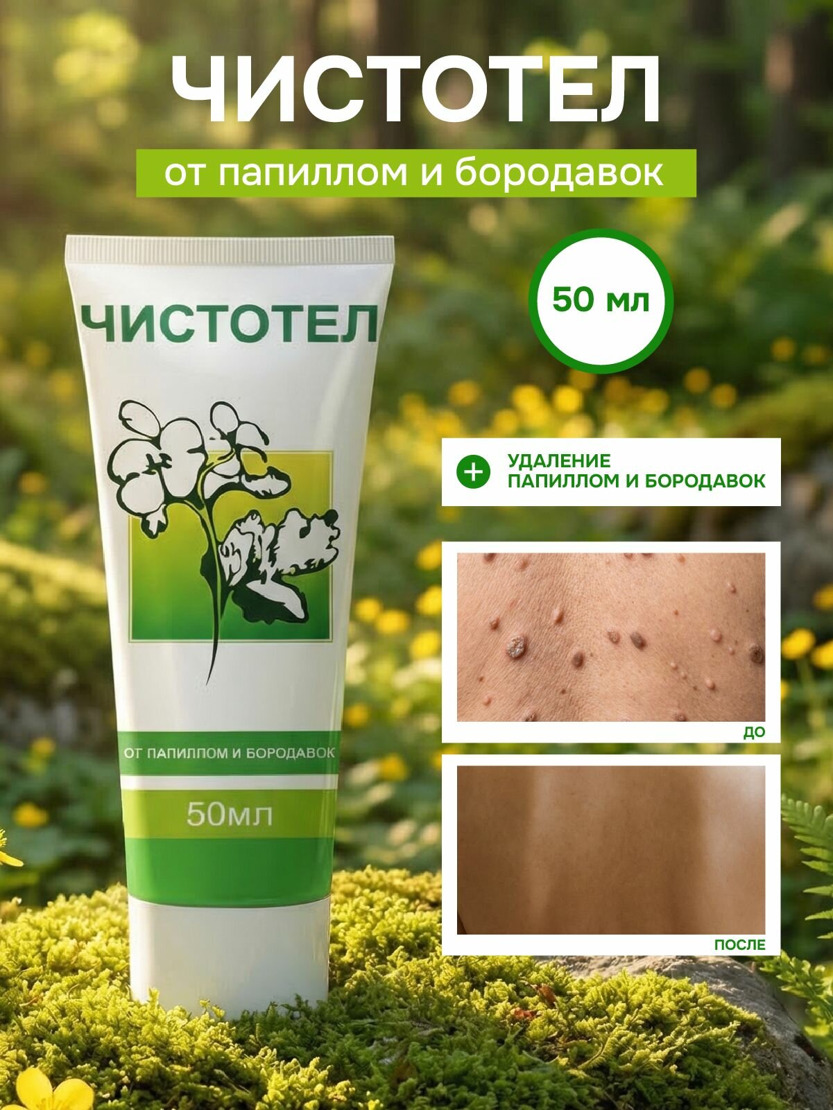 Чистотел от папиллом и бородавок