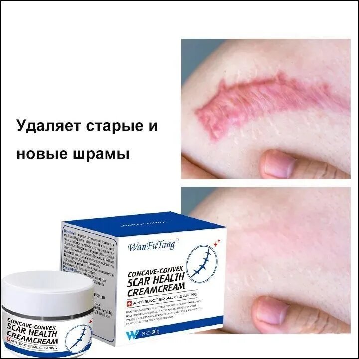 Медицинский kрем от шрамов 30г, растяжек для беременных и постакне подростков, без отдушек, лица тела, Удаляет старые новые шрамы