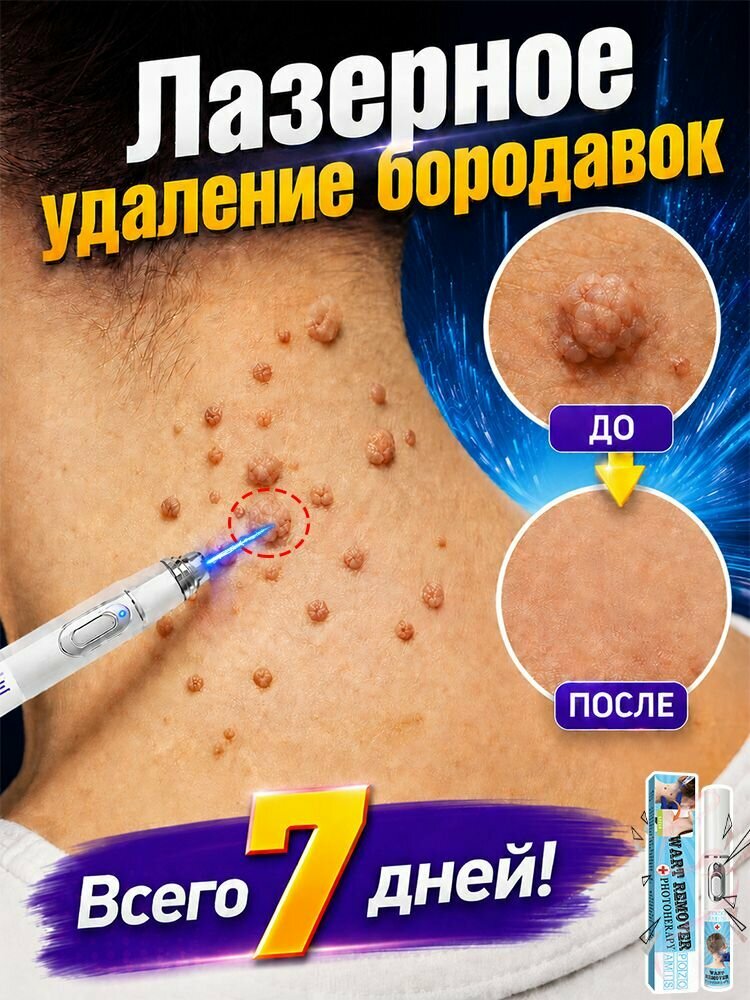 Лазерное удаление бородавок. Удаляет различные бородавки, папилломы и родинки; безболезненно, не оставляет шрамов, очищает и восстанавливает кожу. 1 единица удаление папиллом удаление родинок без рубцов восстановление кожи