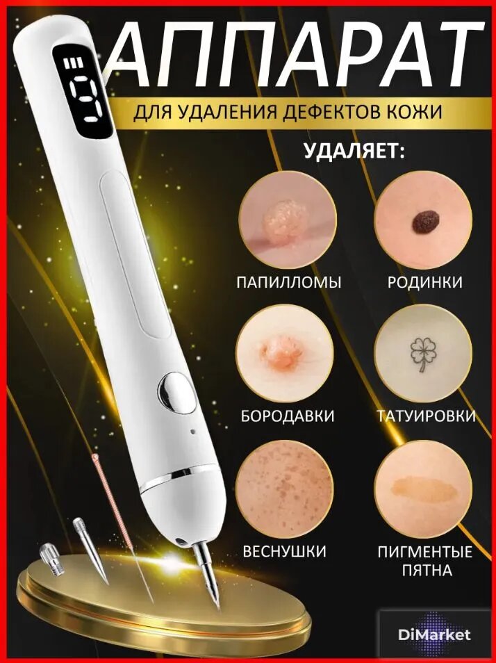 Аппарат для удаления папиллом и бородавок