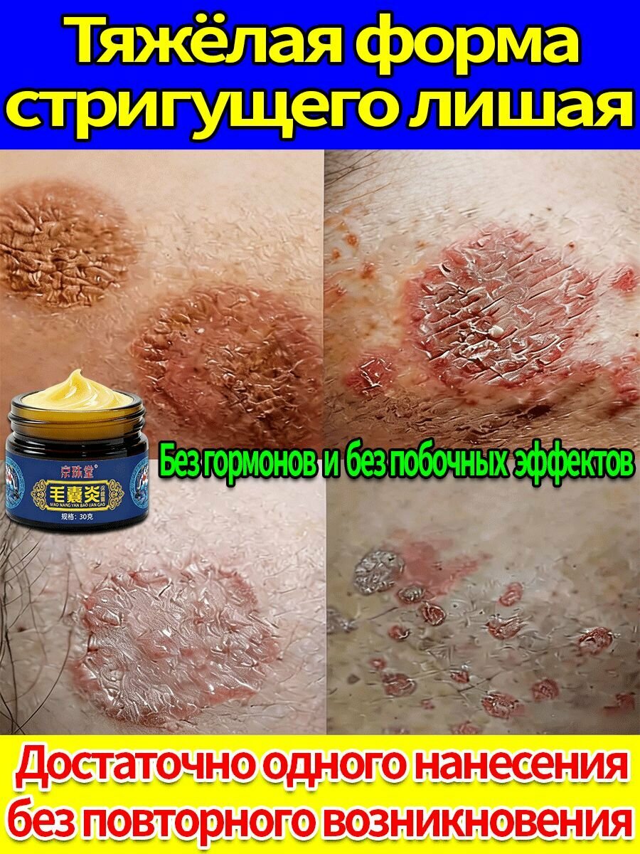 Мазь от лишая для человека