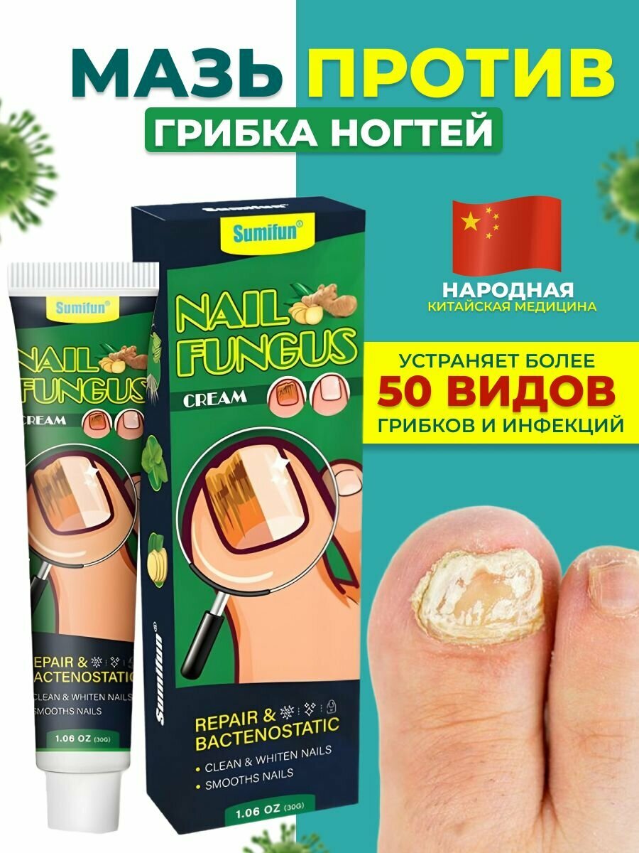 Чудо мазь от грибка ногтей и инфекций