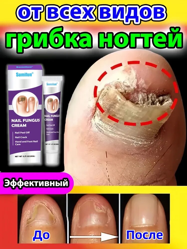 Эффективное средство от грибка ногтей на ногах, противогрибковая мазь для ног, уход за ногтями и кутикулой 20г