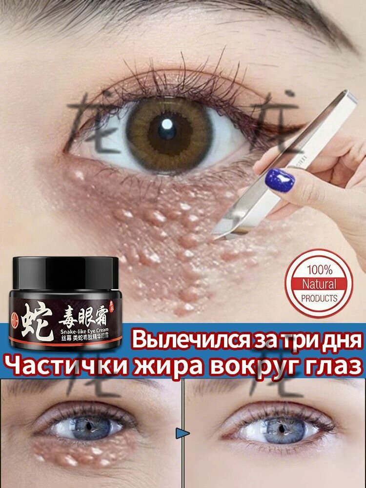Средство от милиумов на лице, Крем для век антивозрастной, для зоны вокруг глаз, от темных кругов и морщин, отёков вокруг глаз, с эффектом лифтинга 30 г