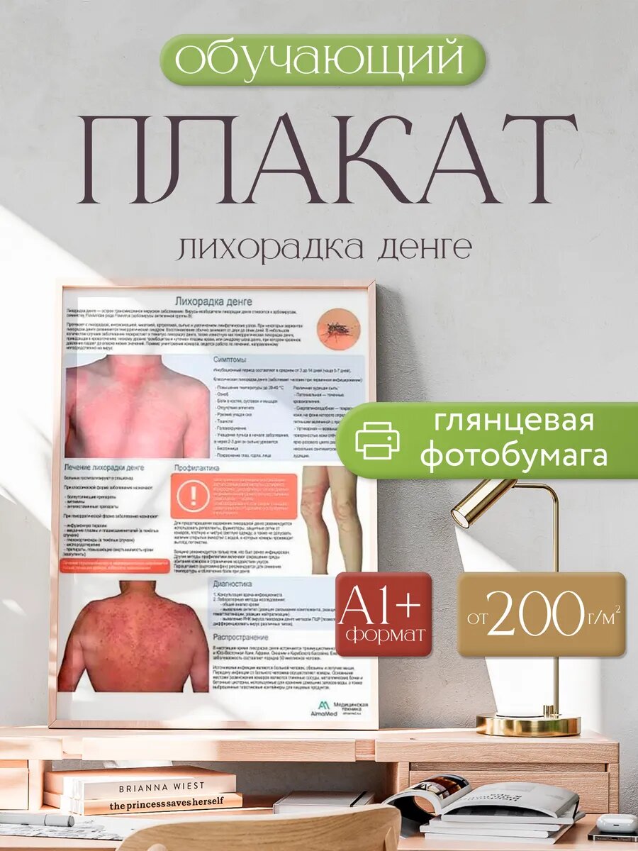 Лихорадка Денге медицинский плакат глянцевая фотобумага от 200 г/кв. м, размер A1+