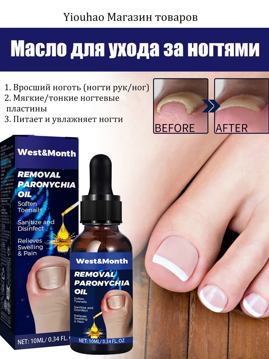 Масло для ухода за ногтями, Инкрустированные ногти на руках и ногах, ногти на ногах, мягкие ногти, увлажняющий уход