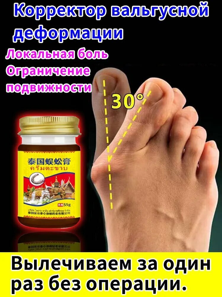 Мазь обезболивающая при вальгусной деформации стопы, снимает боль и отек, натуральный состав, 55г, для домашнего ухода