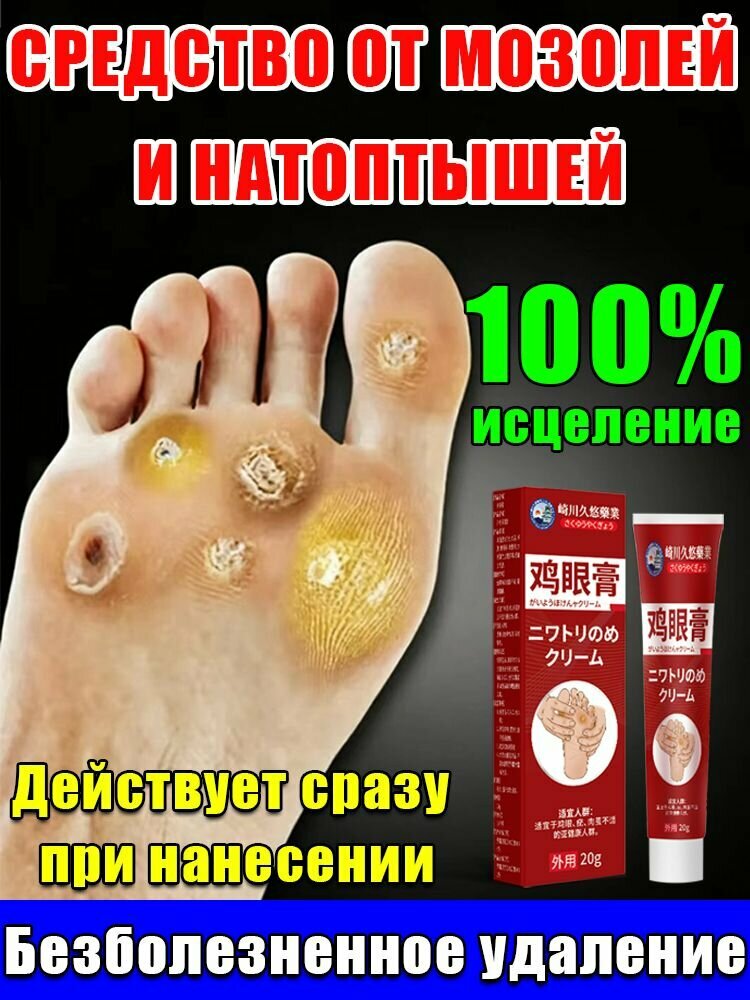Мазь от стержневых мозолей на ногах смягчение и уход