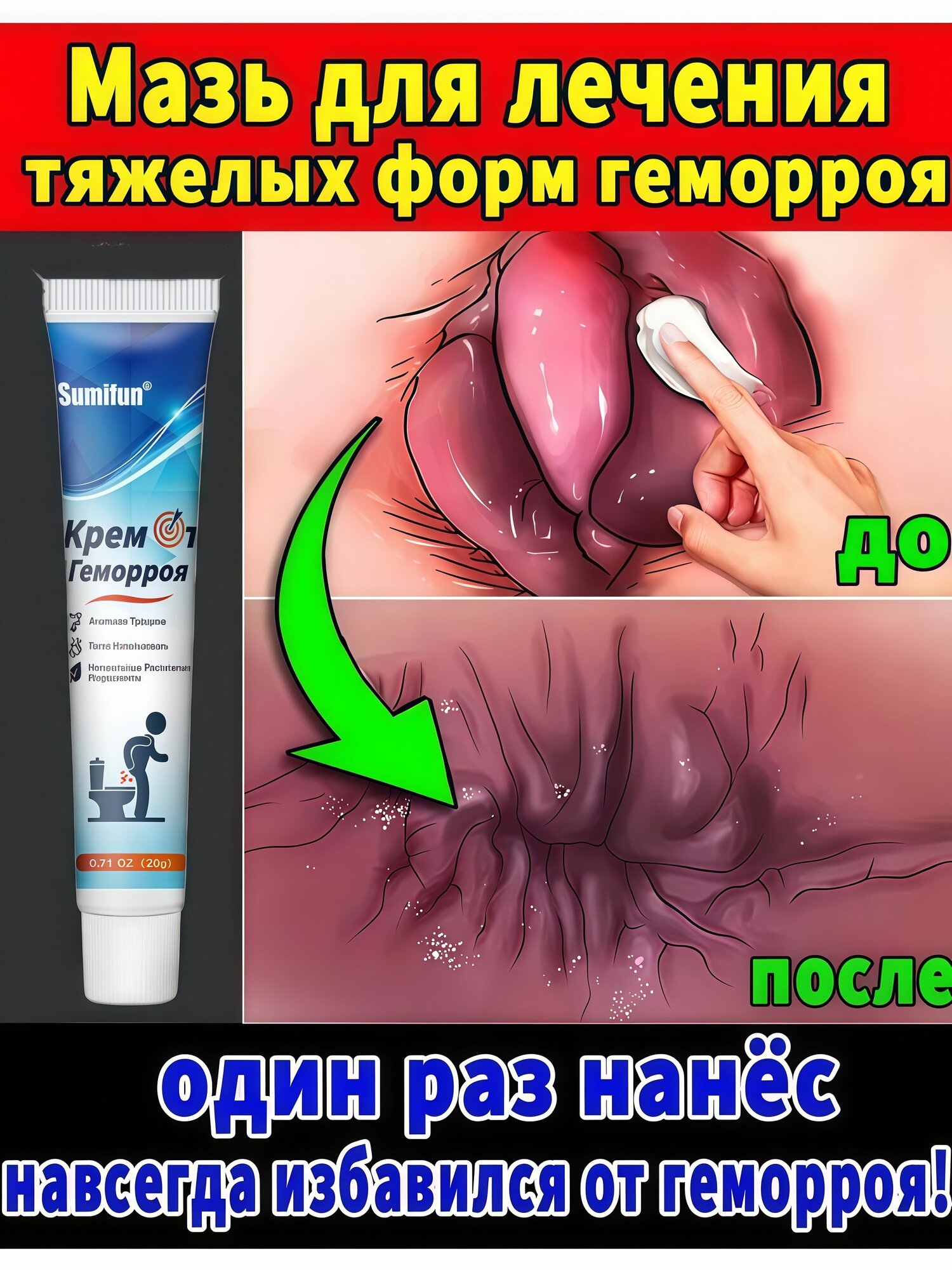 Мазь от геморроя китайское средство гербальный крем быстрое облегчение снятия зуда и отека без рецепта, не гормональная