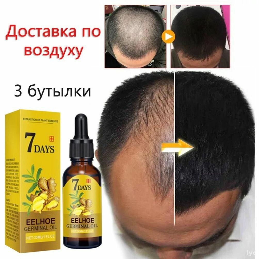 Эксклюзивный набор из 3 бутылок эфирных масел против выпадения волос для интенсивного роста и лечения кожи головы у мужчин и женщин