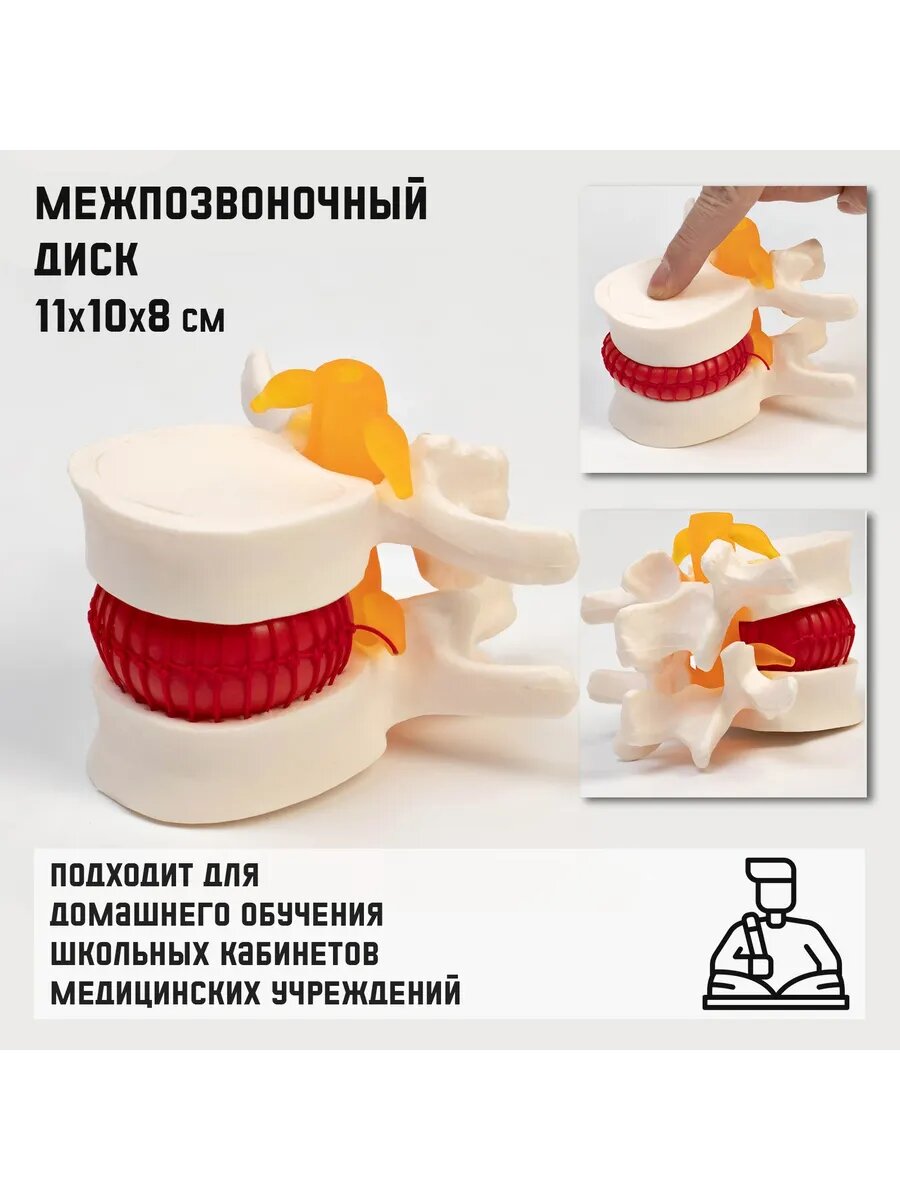Макет межпозвонкового диска