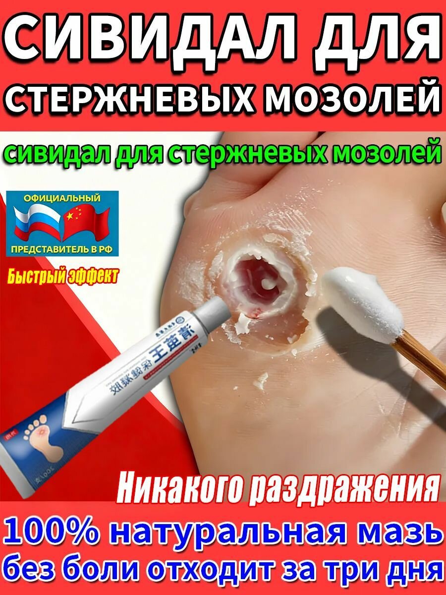 Средство от шипиц, натоптышей и сухих стержневых мозолей на ногах мазь и гель Корнекс, эффективное китайское средство