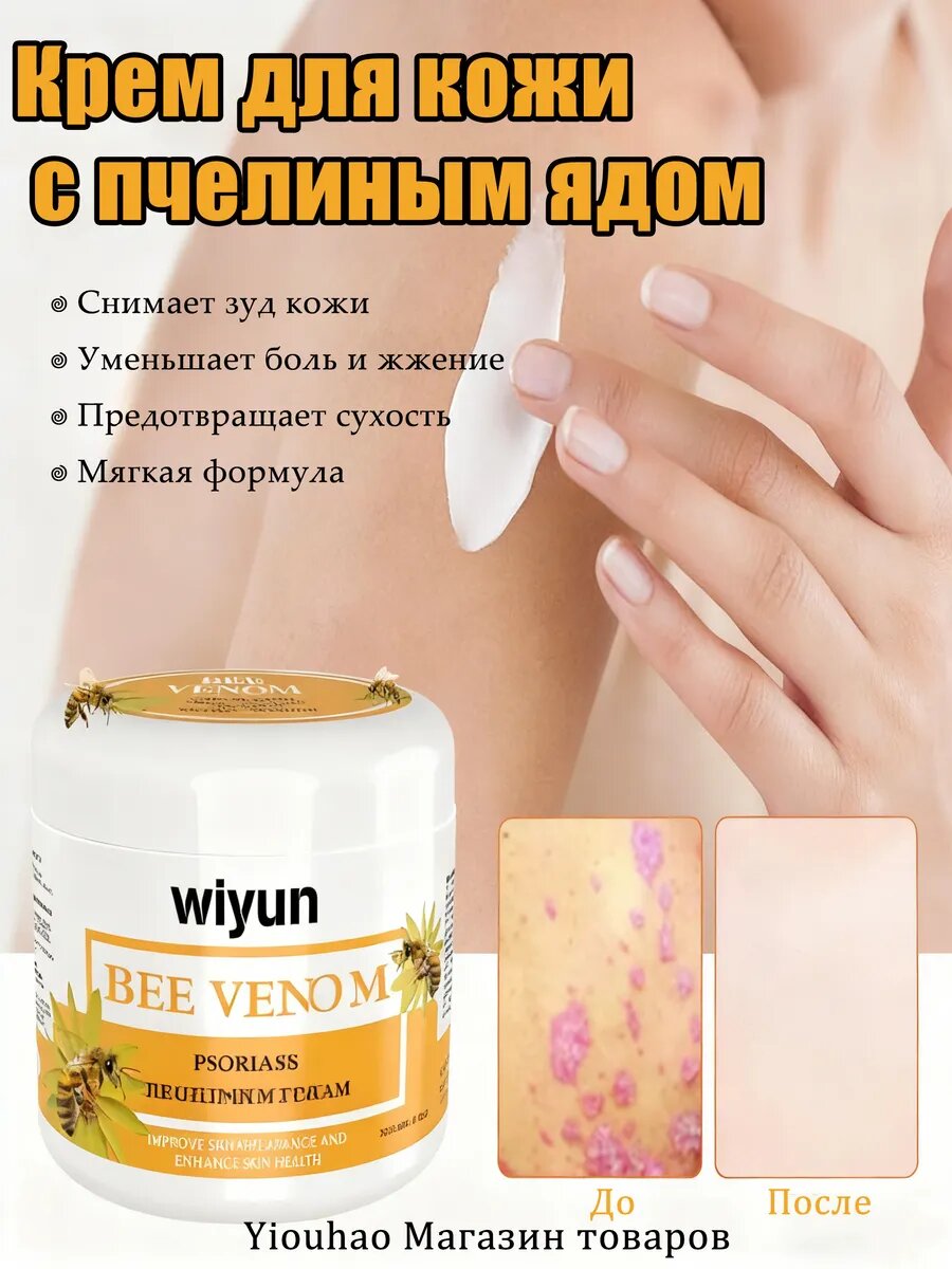 Крем при псориазе, для сухой и раздраженной кожи, увлажнение и восстановление кожного барьера