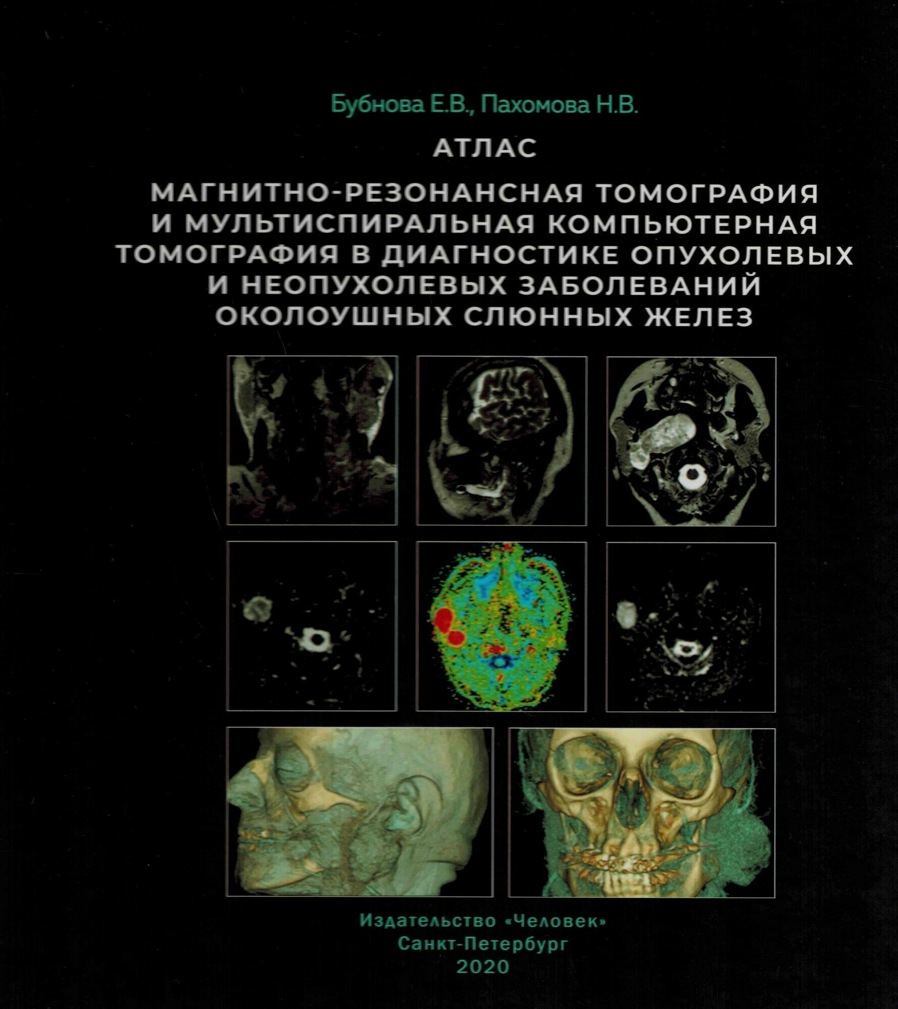 Магнитно-резонансная томография и мультиспиральная компьютерная томография в диагностике опухолевых