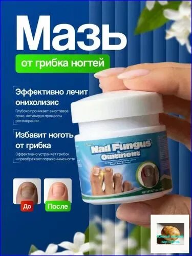 Мазь от грибка ногтей Sumifun / Крем для эффективной борьбы с несовершенствами / Чудо средство для ухода за ногами против онихолизиса
