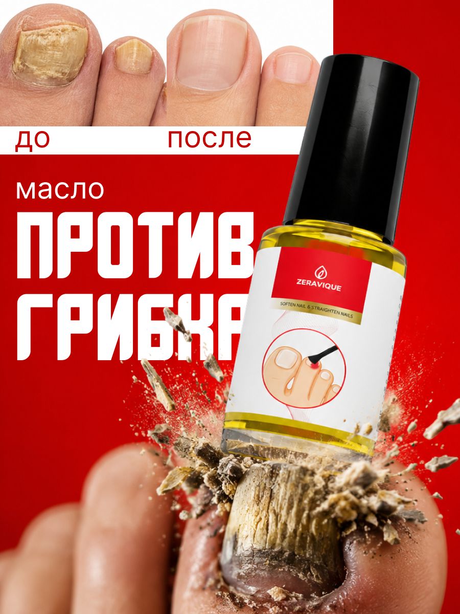 Масло для ногтей от грибка, средство для лечения грибка, 10 мл, лечение онихолизиса